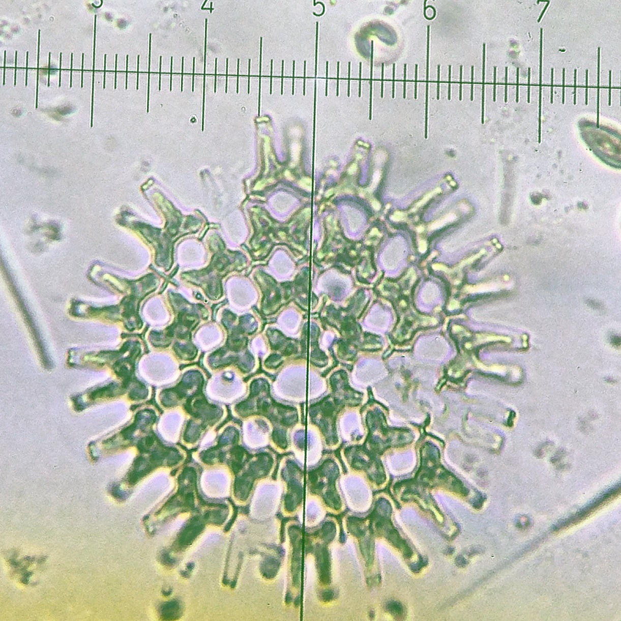 Pediastrum duplex – Science Thursday