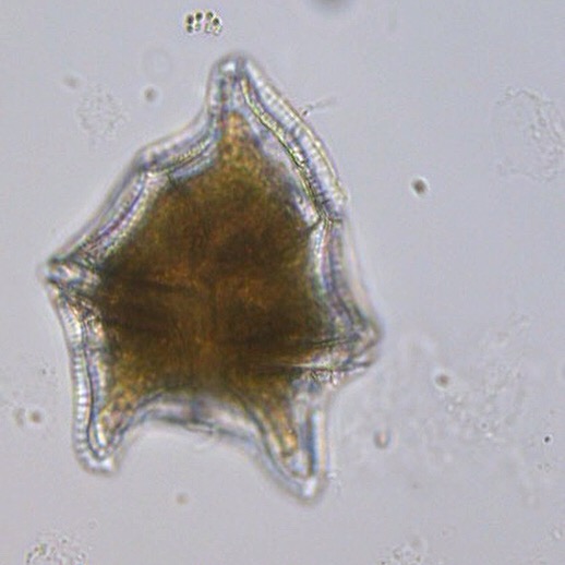 Peridinium sp. – Science Thursday